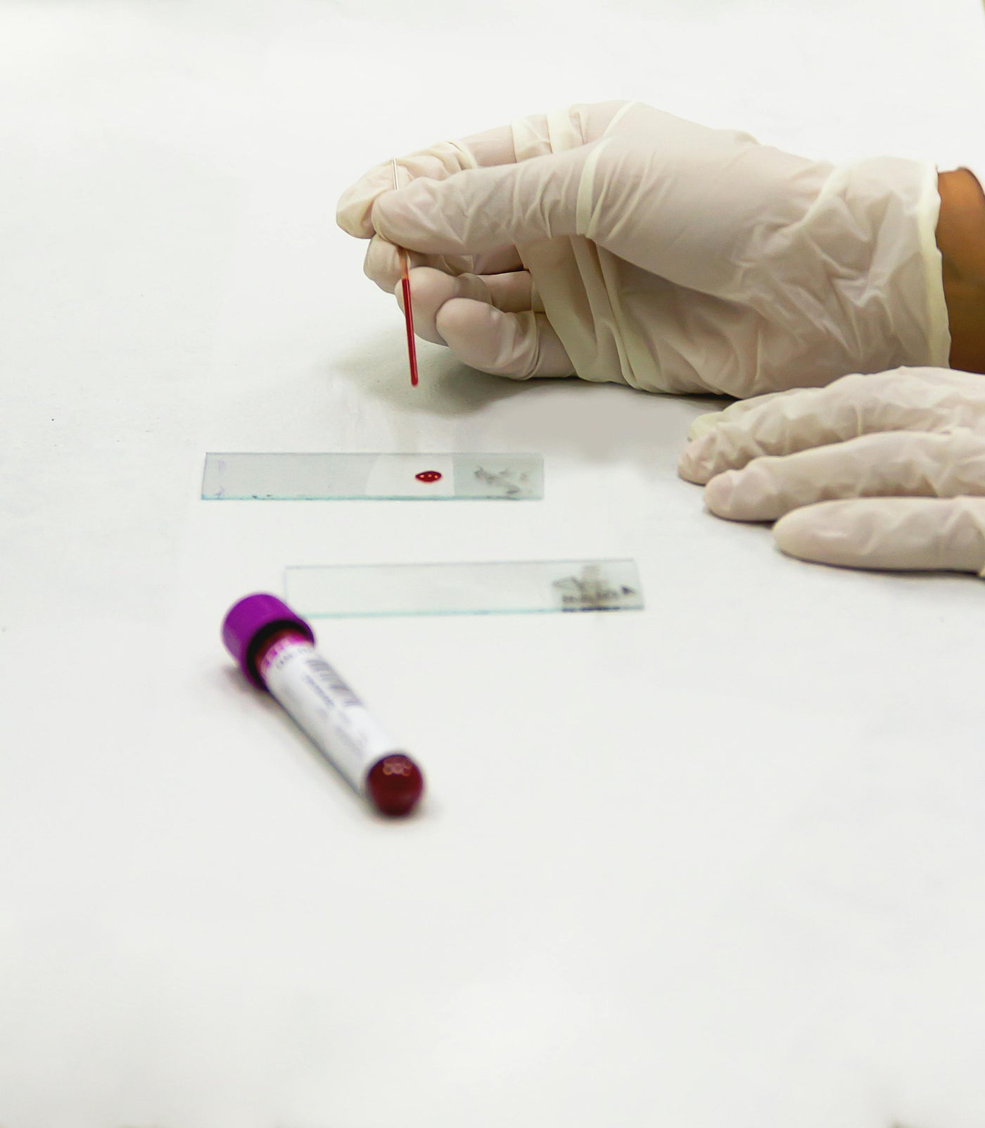 Testosterone Therapy – Alpha Edge Clinic